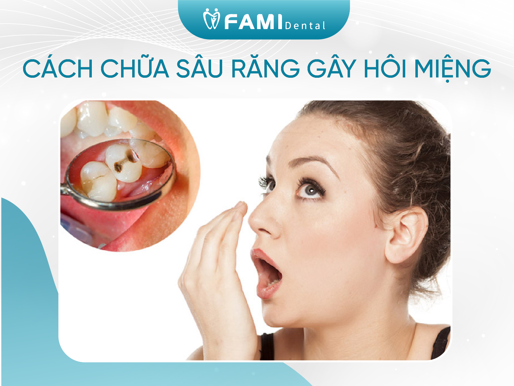 Sâu răng gây hôi miệng và 4 cách điều trị đơn giản nhất